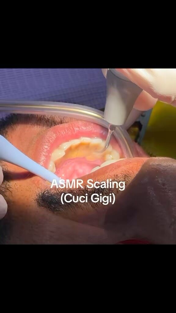 Klinik Gigi Dental Bloom, Shah Alam - Braces, Whitening &Lain-lain